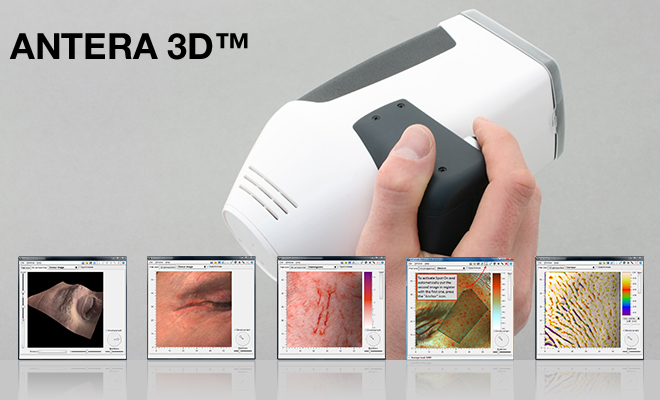 アンテラ3D│日本アッシュ株式会社